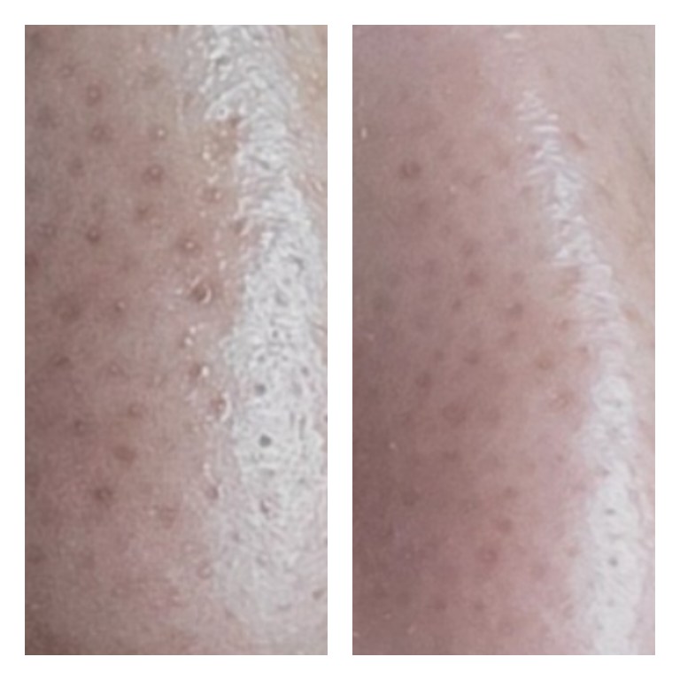 How to Shrink Pores | Oil Gritting Deep Pore Cleansing Facial – Fifty ...